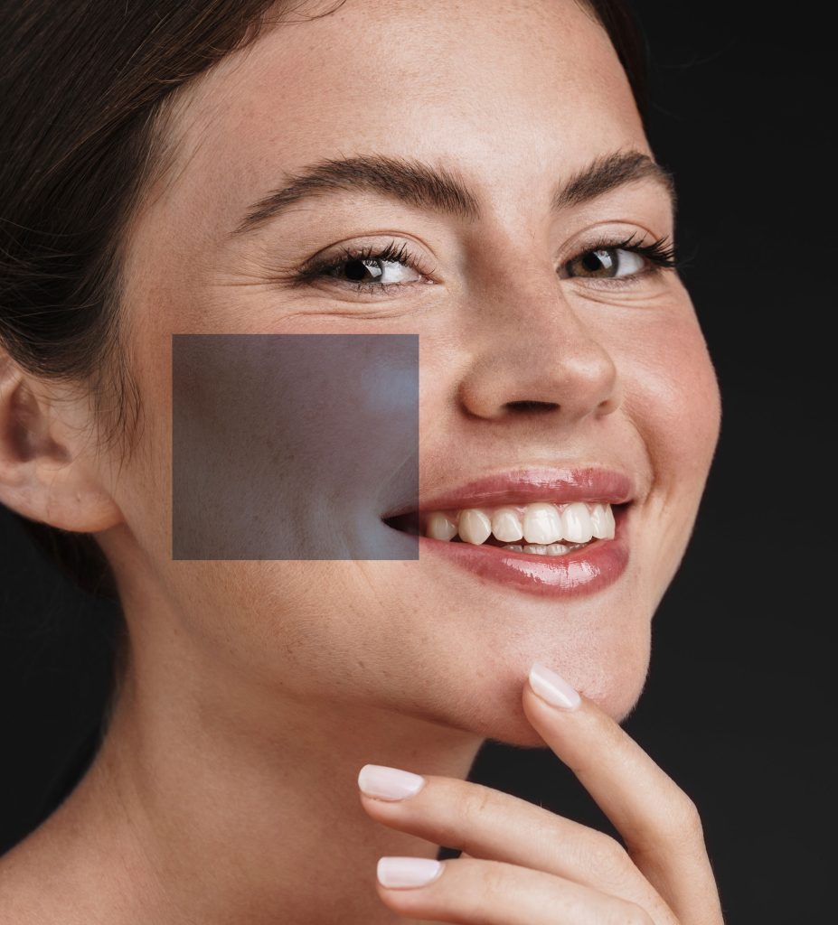 Hyaluronsäure Filler Linz & Wels - Faltenbehandlung - Dr. Mayr